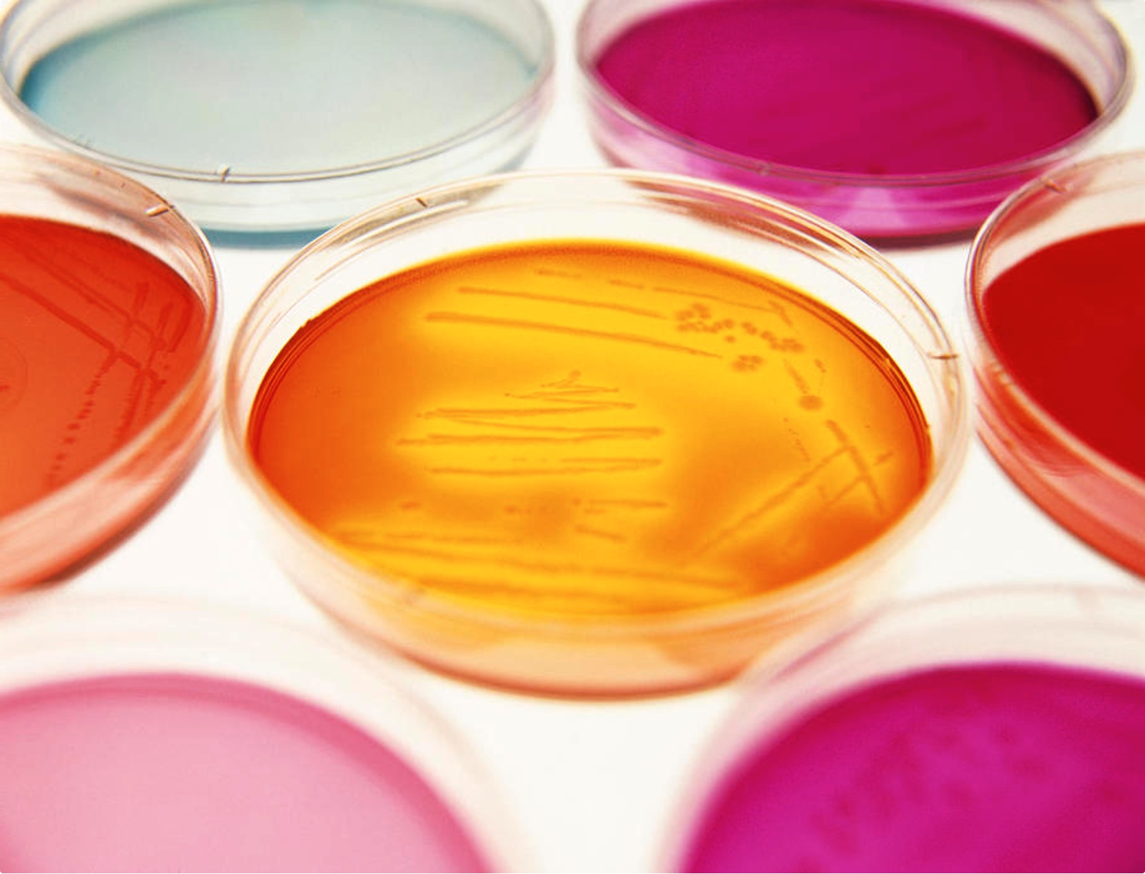Diseases of Civilization: Viruses and Fear – Culturequake